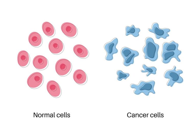 Benign vs. Malignant Tumours: Key Differences Explained